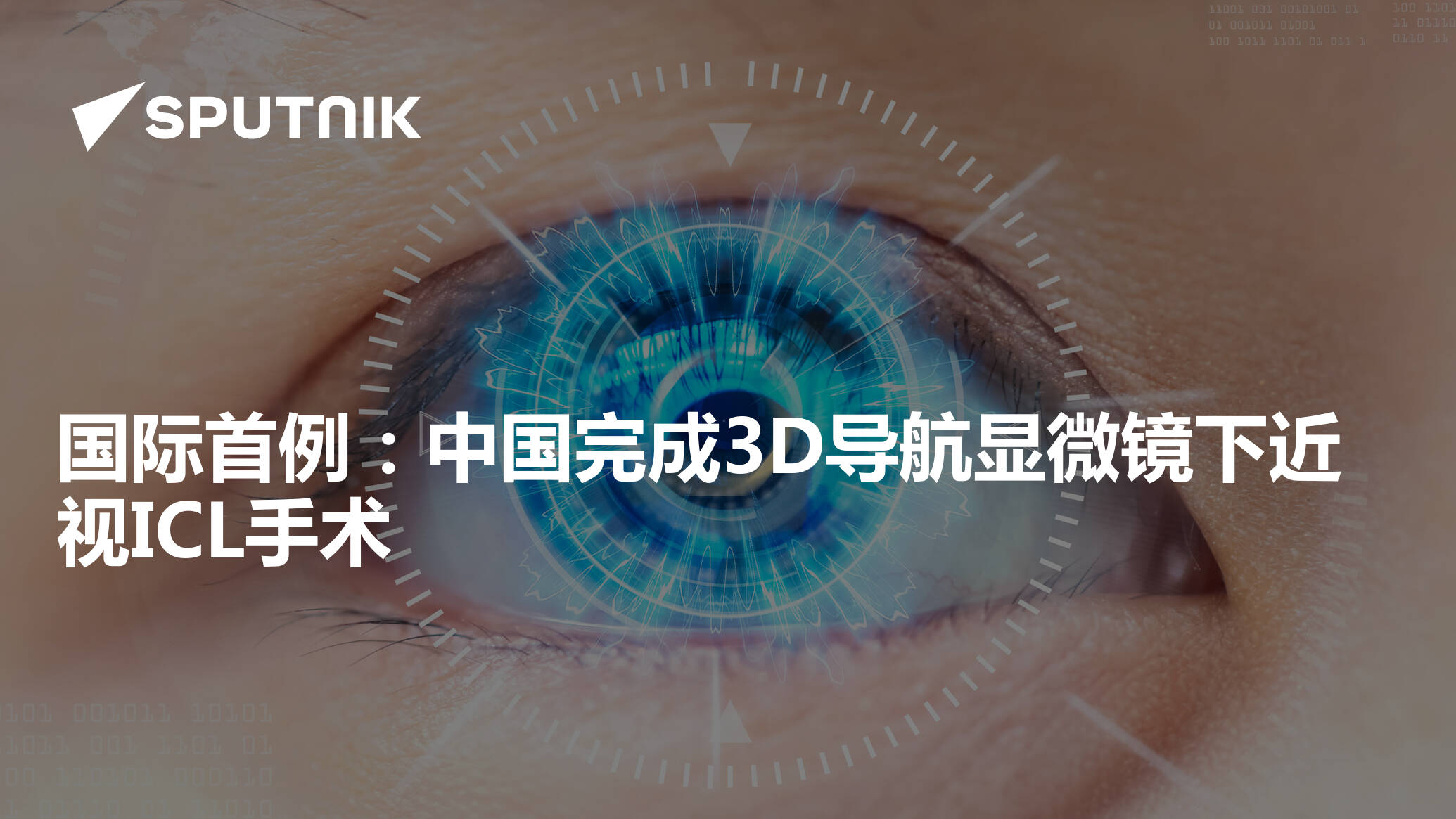国际首例：中国完成3D导航显微镜下近视ICL手术 - 2022年10月24日, 俄罗斯卫星通讯社